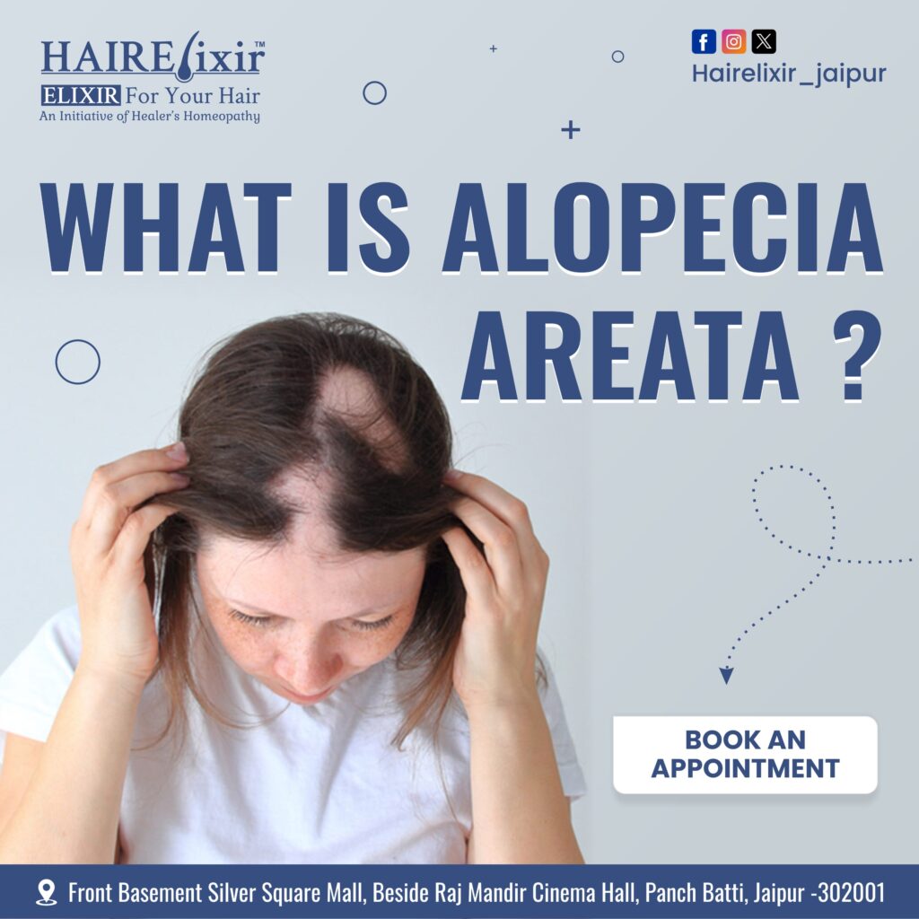 What is Alopecia Areata? - Haircare